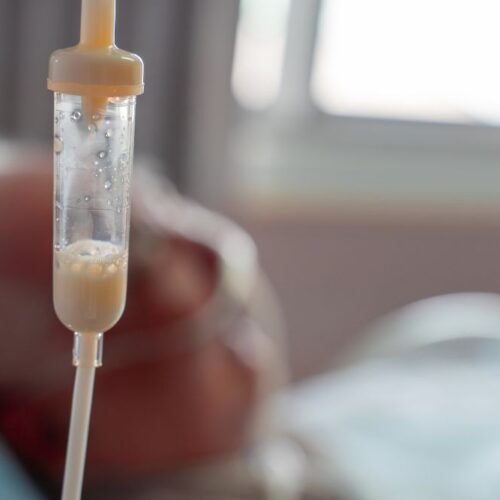 Parenteral nutrition in the NICU | Dietitians On Demand Blog